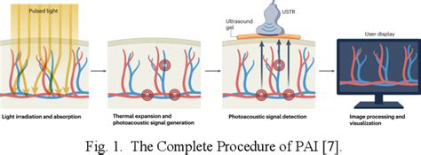Figure 1 From Advances In Photoacoustic Imaging Reconstruction And Quantitative Analysis For