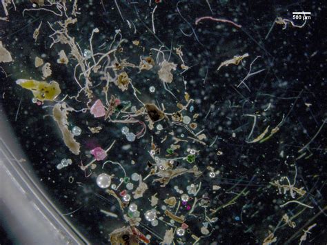 Microplastics Professor Says Illegal Sewage Dumping Is Filling Uk