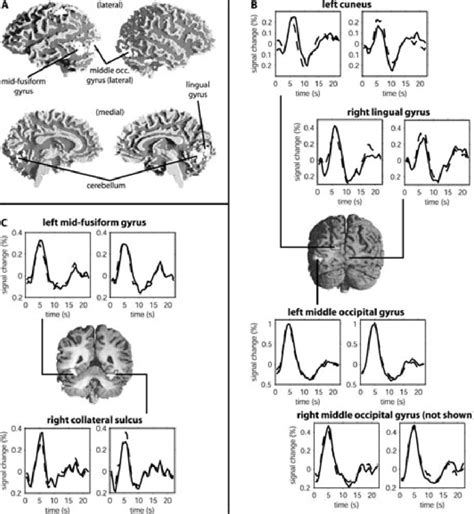 Brain Regions Displaying An Interaction Of Stimulus Type And