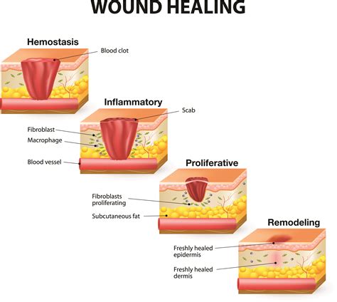 Wound Healing Steps
