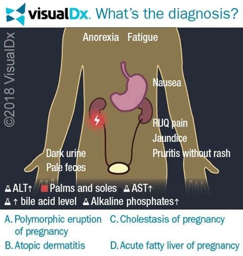 Pregnant Woman Has Itchy Palms Soles Lets Diagnose Visualdx