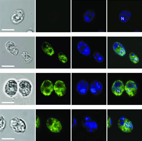Immunofluorescence Localization Of Flag Cbp Tagged Vig1 Phase Contrast