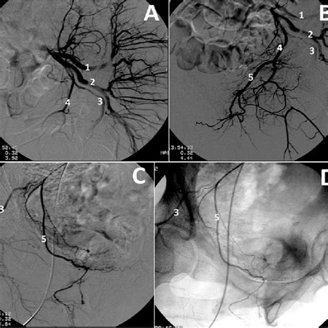 Anatomy Of The Internal Pudendal Artery A Sagittal Mip And B 3d Vr