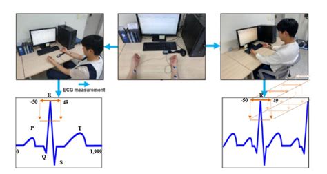 Bio Metric Authentication With Electrocardiogram Ecg By Considering