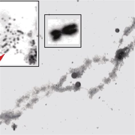 Pdf Structure And Functions Of Lampbrush Chromosomes