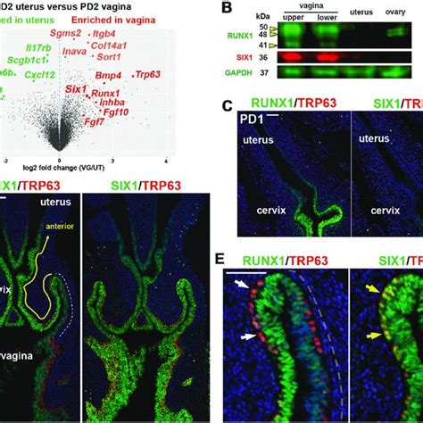 Six1 Is A Downstream Transcription Factor Of Bmp4 Smad Pathway In All