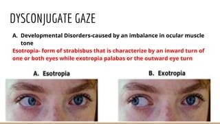 The Eye Ppt