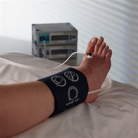 Ankle Brachial Pressure Index Abpi Laser Doppler Moor Instruments