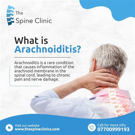 What Is Arachnoiditis Artofit