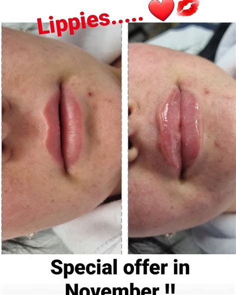 Ultralux Advance Aesthetic Clinicand Training Microblading