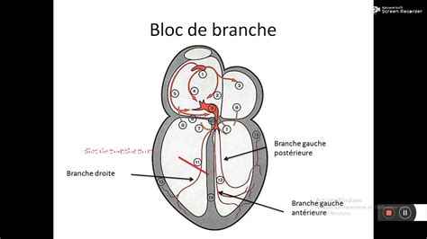 Troubles Conductifs Dr Aoumeur Youtube