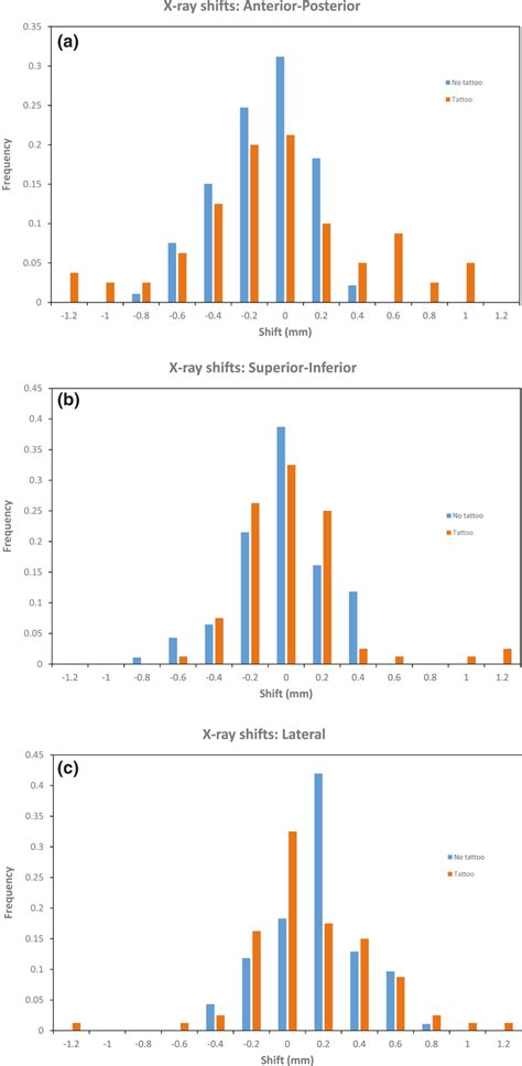 Setup Errors Detected By X Rays Following Surface Imaging Download