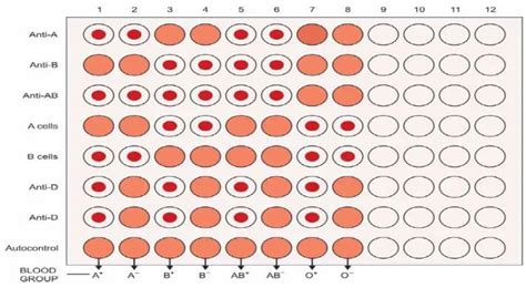 Microplate Technique For Rh D Grouping