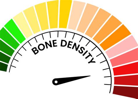 300 Bone Density Scan Stock Illustrations Royalty Free Vector Graphics And Clip Art Istock