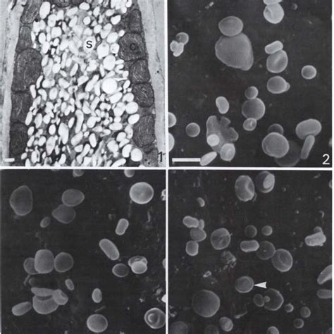Floridean Starch From Immature Seirospores Of Seirospora Griffithsiana