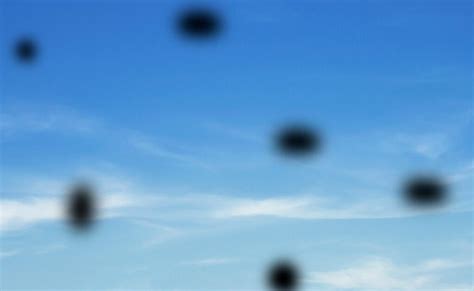 Vitrectomy For Floaters Floaters Clinic Floaters Treatment In Tijuana