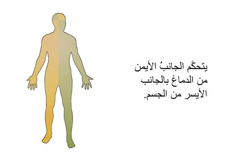 الشلل الدماغي