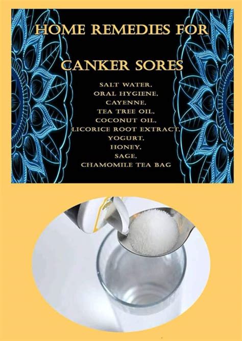 Home Remedies For Canker Sore On Gum