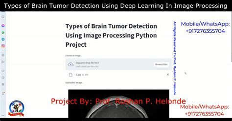 Types Of Brain Tumor Detection Using Deep Learning Brain Tumor Types