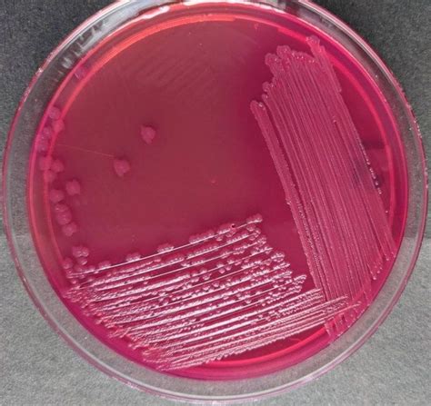 Macconkey Agar Composition Uses Colony Characteristics • Microbe