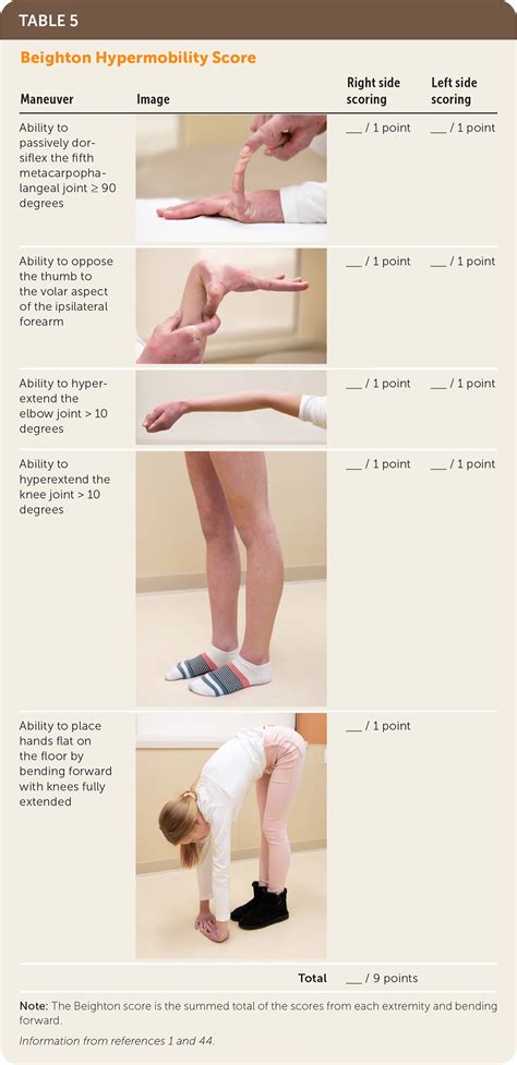 Hypermobility Spectrum Disorder Explained Epimgq