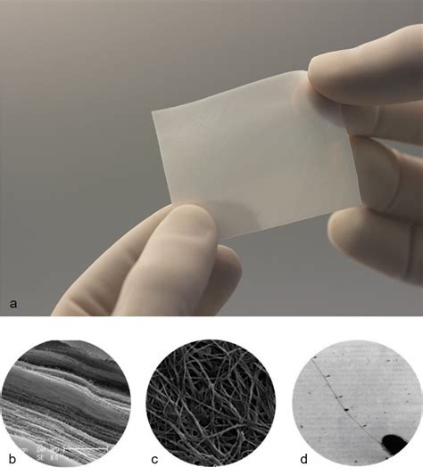 Synthecel Dura Repair