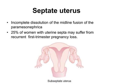 Congenital Anomalies Of Female Reproductive System Pptx Pregnancy