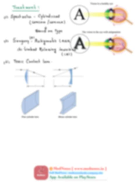 Solution 2 Astigmatism Optics Refraction Full Notes Studypool