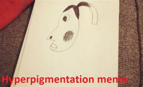 The Viral Rise Of The Hyperpigmentation Meme Humor Awareness
