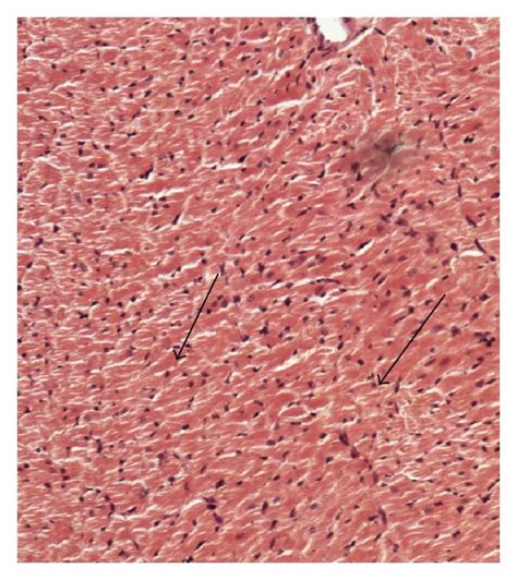 A Cardiac Tissues Of Control Group Showing Normal Structure Of