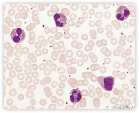 小世界，大哲学：粒细胞中性粒细胞？（多图） 知乎