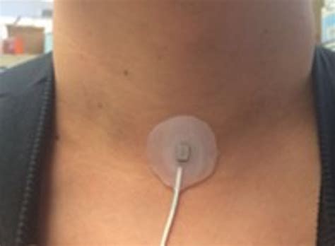 Listening To Asthma And Copd An Ai Powered Wearable Could Monitor Respiratory Health