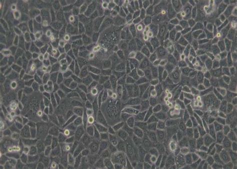 人子宫颈表皮癌细胞 Me 180金少源上海生物科技有限公司 人子宫颈表皮癌细胞 Me 180金少源上海生物科技有限公司