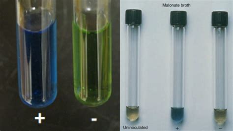 Malonate Test Principle Procedure Results Uses Biology Notes Online