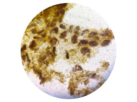 Premium Photo Stool Examination Under Light Microscopy Stool Analysis