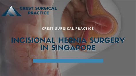 Expert Care For Complex Hernia Repair In Singapore