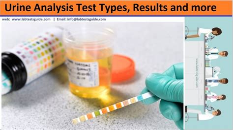 Urinalysis Urine Test Types Results And More Lab Tests Guide