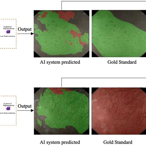 Examples Of Calculation Process Of Diagnosing Intrapapillary Capillary Download Scientific