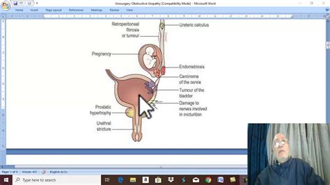 Urology 18 Obstructive Uropathy By Dr Wahdan Youtube