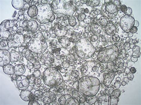 3dgro™ Duodenum Intestinal Organoids Age 55 Prep 89 D Scc326