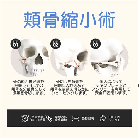 【韓国整形韓国美容外科】顔面輪郭手術、a To Z（3d頬骨、230度頬骨） 「顔面輪郭専門」立体美容外科