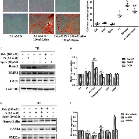 Aldosterone Aldo Accelerated High Phosphate Piinduced Vascular