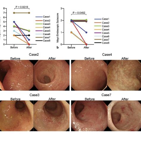 Fmt Achieved Cr In Patients With Uc Adapted Mayo Score A And Mayo Download Scientific