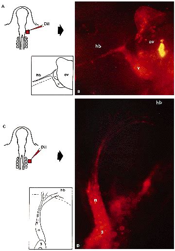 Dii Mapping Of The Presumptive Placodal Ectoderm Regions For Vestibular
