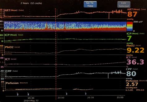 Recollecting The Cns Monitor Moberg Analytics