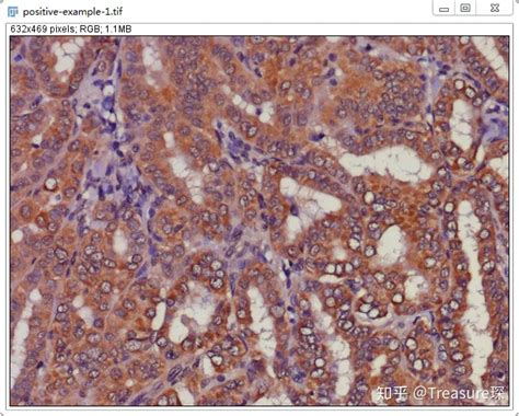 imagej灰度值量化分析 实用技巧——免疫组化分析 定量分析篇 免疫组化定量分析imagej csdn博客