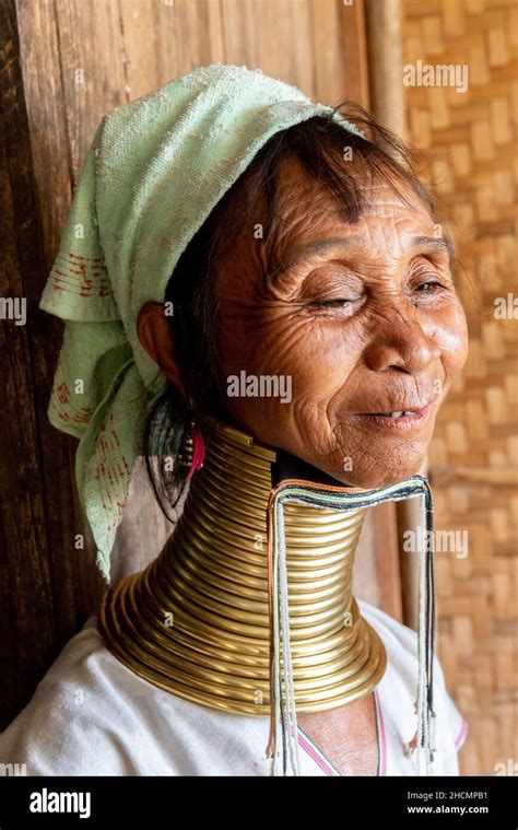 Neck Rings Removed