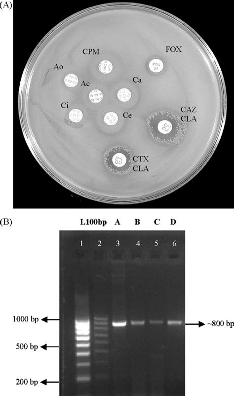 Demonstration Of Extended Spectrum Lactamase Esbl From Acinetobacter Download Scientific
