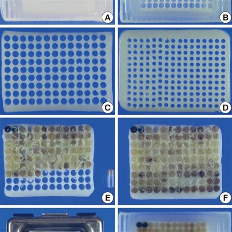 Tissue Processing Protocols Used For Preparation Of The Agarose Gel To