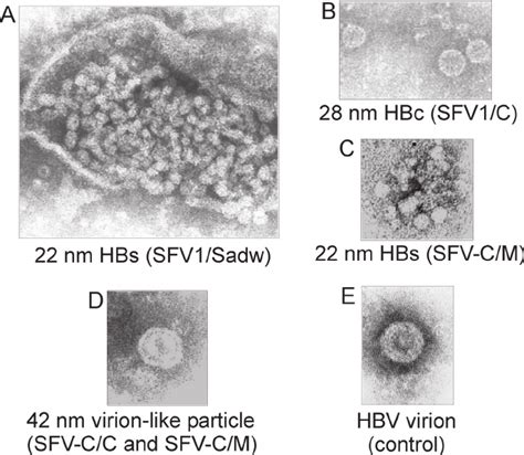 Electron Micrographs Of Hbv Particles A Hbsag 22 Nm Like Particles In